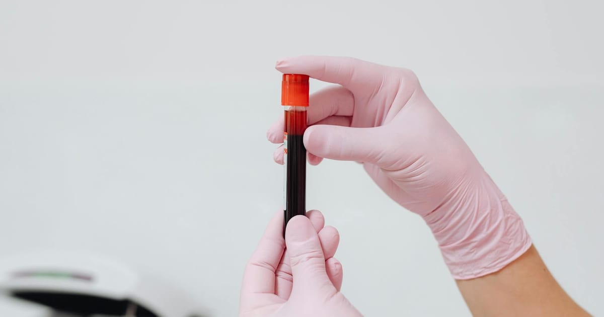 How Often Should Adults Get a Blood Test? | Screening Clearing